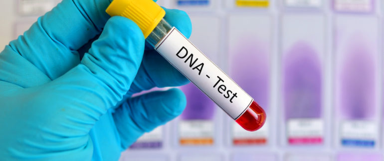 Créa pharm | Qu’est-ce qu’un test ADN